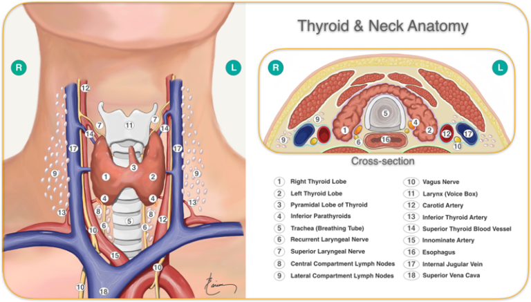 Minimally Invasive Thyroidectomy - Larian, MD
